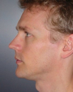 FaceGen Modeller PhotoFit Samples